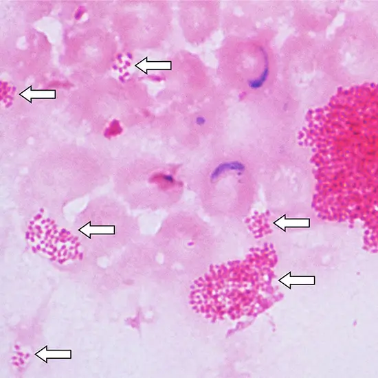 Brucella Antibodies Panel IgG and IgM | Test Price In Delhi, India ...