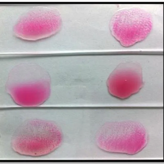 Brucella Agglutination Test Near me in Delhi | Test Price & Cost ...