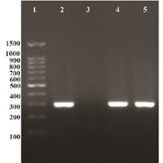 Chlamydia Trachomatis PCR | Test Price In Delhi | Cost Near Me, India ...
