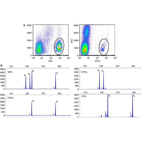 Chimerism Split Cell Analysis- Myeloid Cell (CD15) Test | GDIC