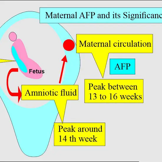 Autoimmune Encephalitis Panel, CSF Test Cost in Delhi | GDIC