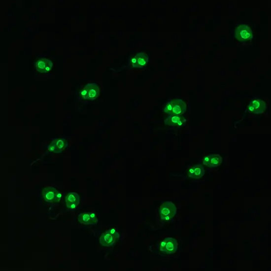 Double-Stranded DNA (dsDNA) Antibody Crithidia, IFA Test in Delhi | GDIC