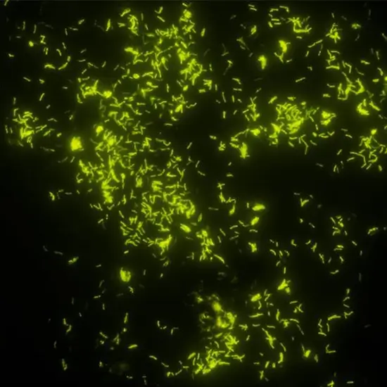 Auramine-Rhodamine Stain Test in Delhi, India | GDIC