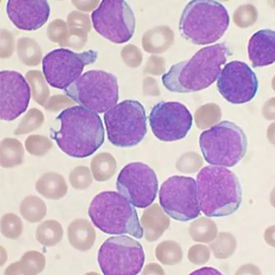 Bone Marrow Smear Microscopic Examination | Test Price In Delhi, India ...