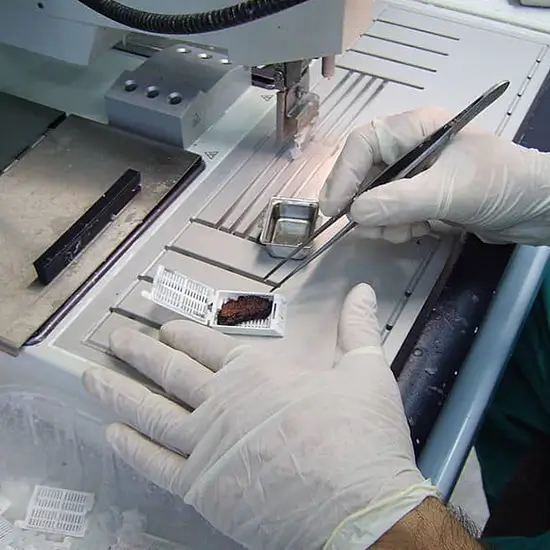 Types Histopathology Tests | Price List Of Histopathology In India ...