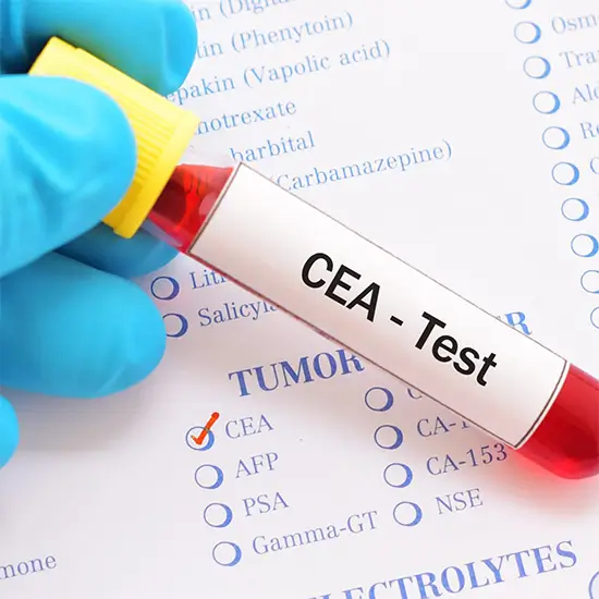 Carcinoembryonic Antigen (CEA) Cancer Marker | Test In Delhi, India ...