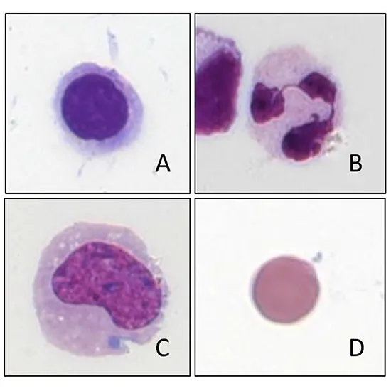 Book Fluid Cell Count | Test Price In Delhi | Cost Near Me, India ...