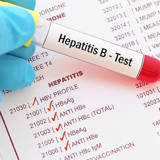 Hepatitis B Core Antibody, Total Quantitative Test in Delhi NCR, India ...