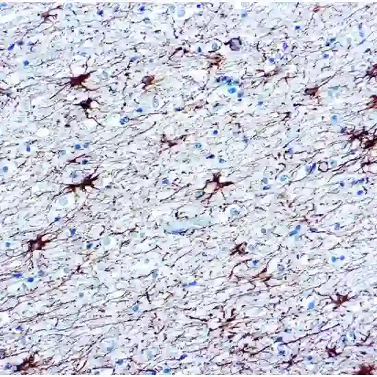 IHC - Glial Fibrillary Acidic Protein (GFAP) Test in Delhi NCR, India ...