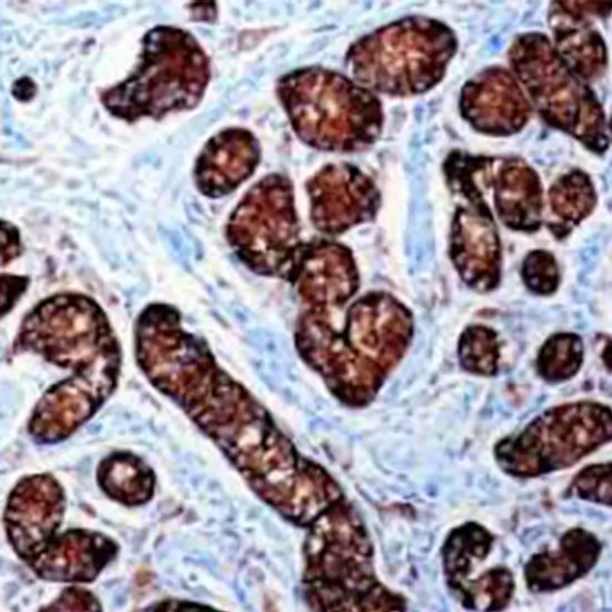 IHC (Immunohistochemistry) Inhibin | Test Price In Delhi, India ...