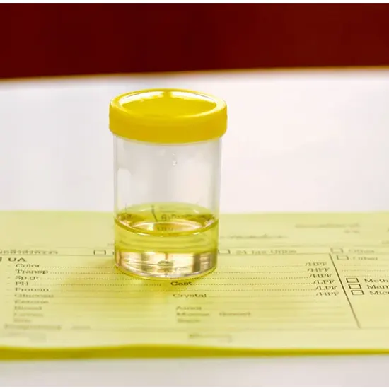 Urinary Cortisol/Creatinine Ratio, 24 Hour | Test In Delhi, India ...