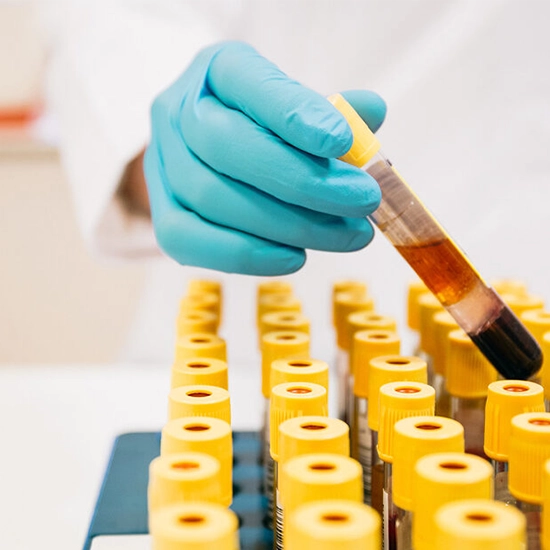 Full Body Health Check-Up - Book Health Packages at Low Cost