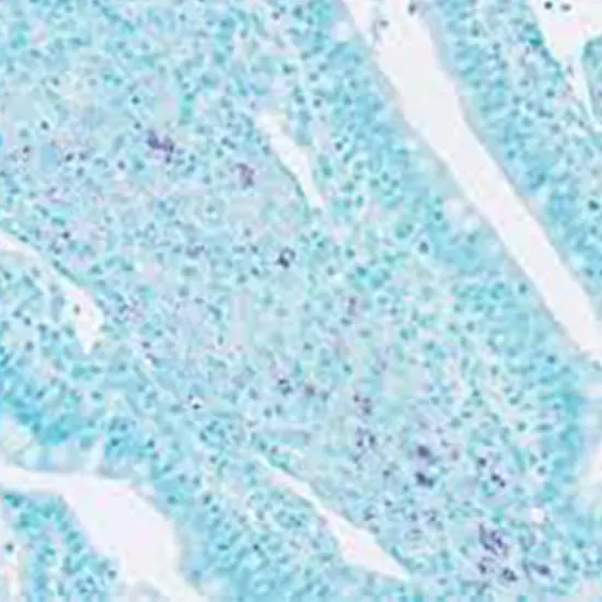 Stain AFB (Kinyoun) Test in Delhi NCR, India | GDIC