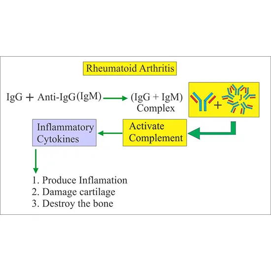 Rheumatoid Factor (RA Factor) Titer Test in Delhi NCR, India | GDIC
