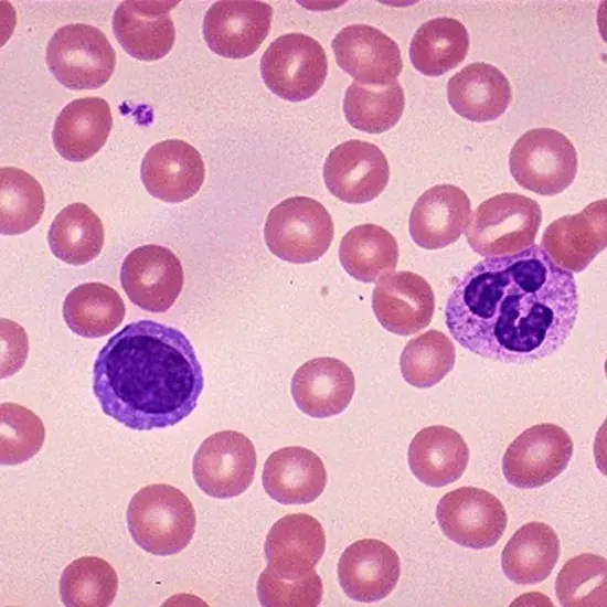 Book Giemsa Stain | Test Price In Delhi | Cost Near Me, India | Ganesh ...