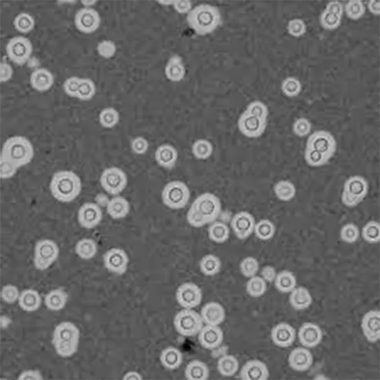 Negative Stain (India Ink) Test in Delhi NCR, India | GDIC