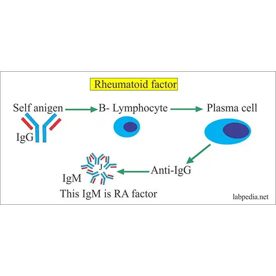 Rheumatoid Factor IgG Antibody | Test Price In Delhi | Cost Near Me ...