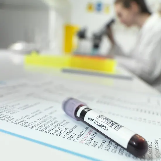 Full Body Health Check-Up - Book Health Packages at Low Cost