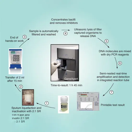 GeneXpert MTB with Rifampicin Sensitivity, Quantitative PCR Test | GDIC