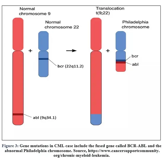 BCR-ABL Gene Translocation (Quantitative) Test in Delhi NCR, India | GDIC