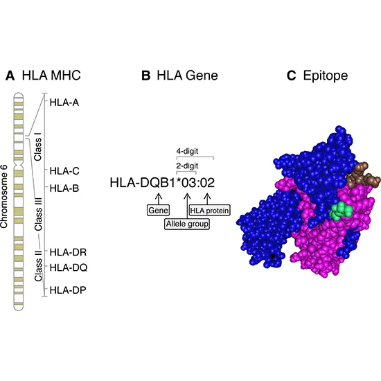 HLA Typing (A, B, C, DR & DQ) Test in Delhi NCR, India | GDIC
