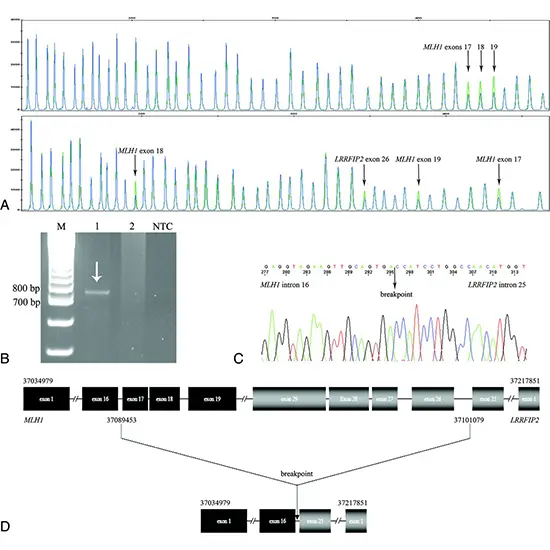 MEN1 Gene Mutation -7 Exons by Sequencing Test | GDIC