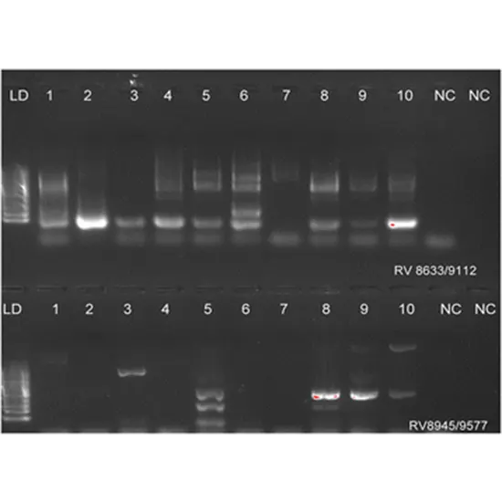 Rubella DNA PCR - Quantitative Test in Delhi NCR, India | GDIC