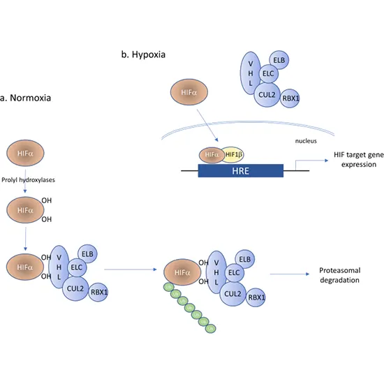 VHL Gene Mutation 3 Exons by Sequencing Test in Delhi NCR, India | GDIC