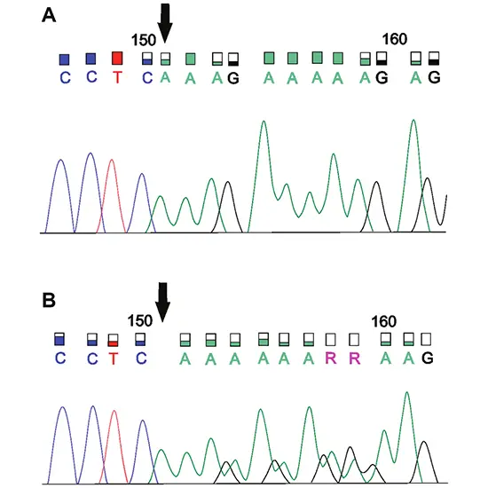 MSH6 Gene Sequencing - Colorectal Cancer Test in Delhi NCR, India | GDIC