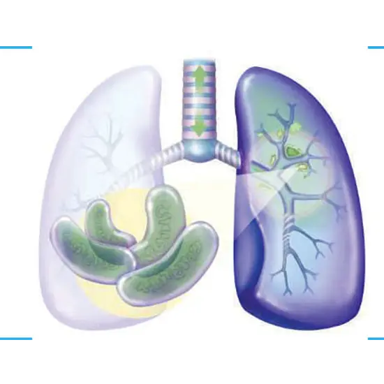Mycobacterium Tuberculosis DNA PCR, Qualitative Test In Delhi, India ...