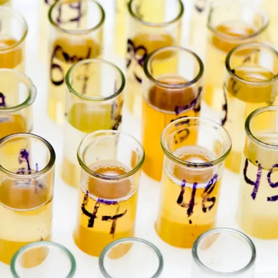 Chest X-Ray lateral view Procedure - Ganesh Diagnostic