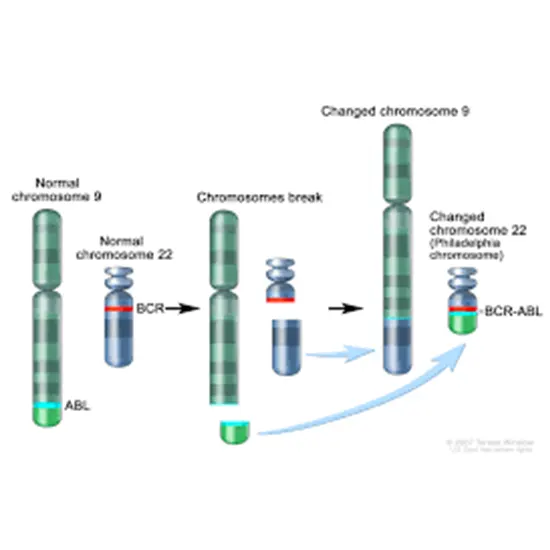 Acute Lymphoblastic Leukemia (ALL) Cytogenetic Panel Test in Delhi NCR ...