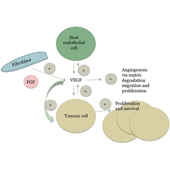 I-131 Low Dose Therapy For Graves Disease Cost In Delhi, India | Ganesh ...