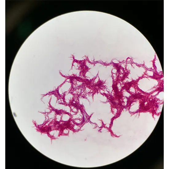 AFB-Identification & Speciation MTB and MOTT by Hains Test in Delhi NCR ...