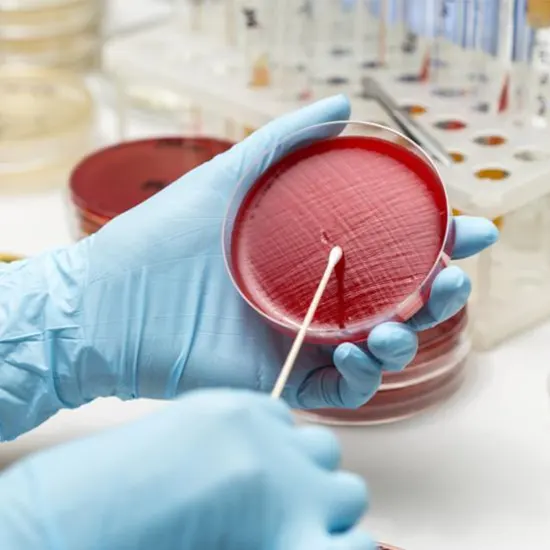 Culture & Sensitivity - Aerobic (Automated) Test in Delhi NCR, India | GDIC