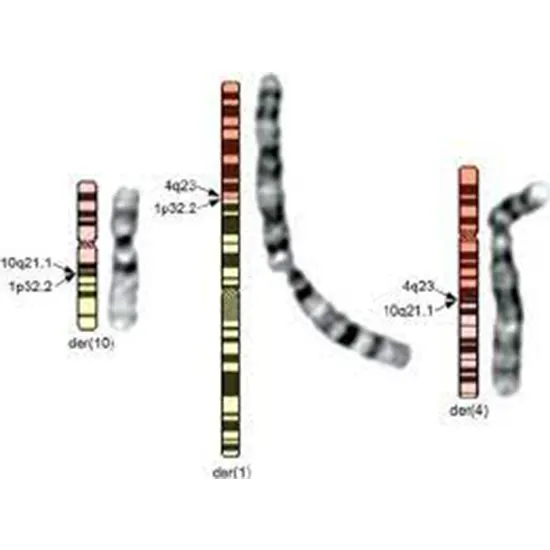 ALL Multiplex Comprehensive Panel with Karyotyping Test in Delhi | GDIC