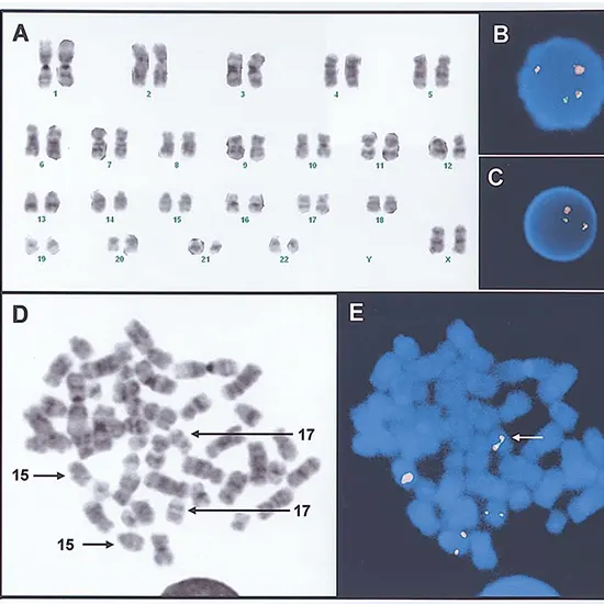 ALL FISH Comprehensive Panel with Karyotyping Test in Delhi | GDIC