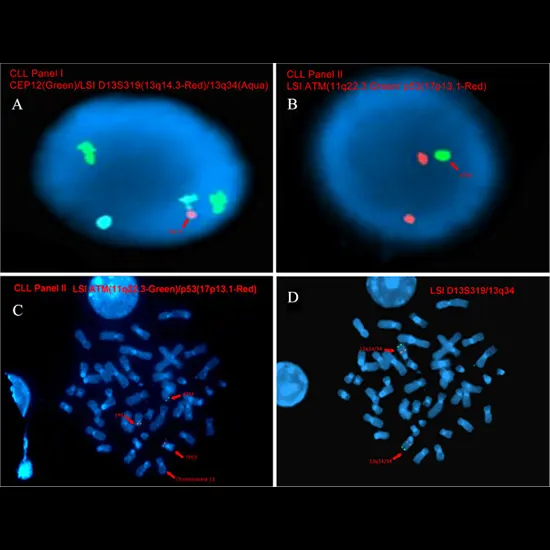 Types Histopathology Tests | Price List Of Histopathology In India ...