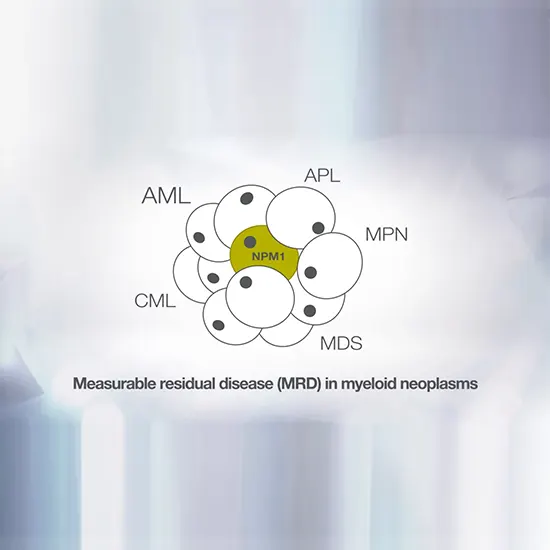 AML Measurable Residual Disease (MRD) Test in Delhi NCR, India | GDIC