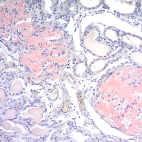 Amyloid Stain (Congo Red) Test in Delhi NCR, India | GDIC