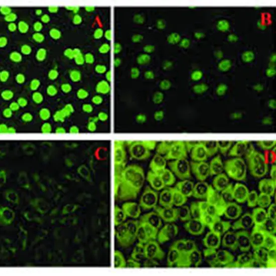 ANA by Immunoblot 17 Antigens Serum Test in Delhi NCR, India | GDIC