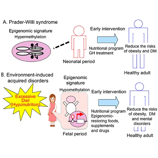 Angelman Syndrome Methylation Test in Delhi NCR, India | GDIC