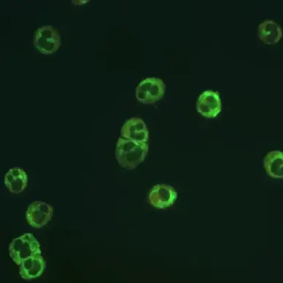 ANCA (Antineutrophil Cytoplasmic Antibodies) IFA | Test Price In Delhi ...