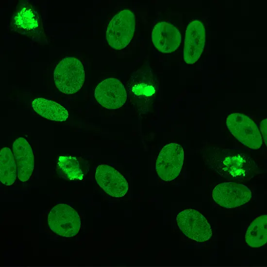 Autoimmune Nuclear Antibody (ANA) Panel Test in Delhi NCR, India | GDIC