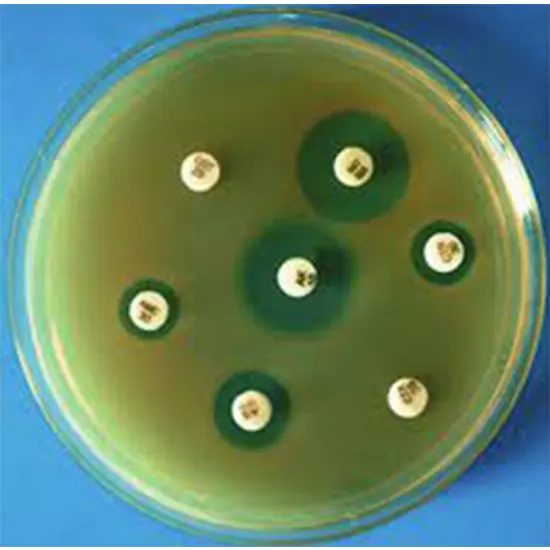 Bacteria Culture and Sensitivity Test in Delhi NCR, India | GDIC
