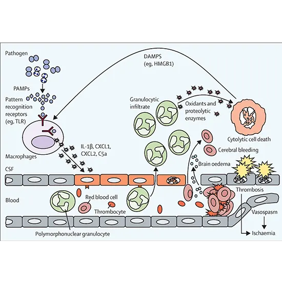 Bacterial Meningitis Panel 5 Antigen, CSF | Test Price In Delhi, India ...