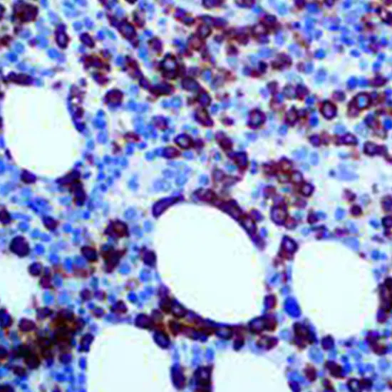 Bone Marrow: Myeloperoxidase (MPO) Stain Test in Delhi | GDIC