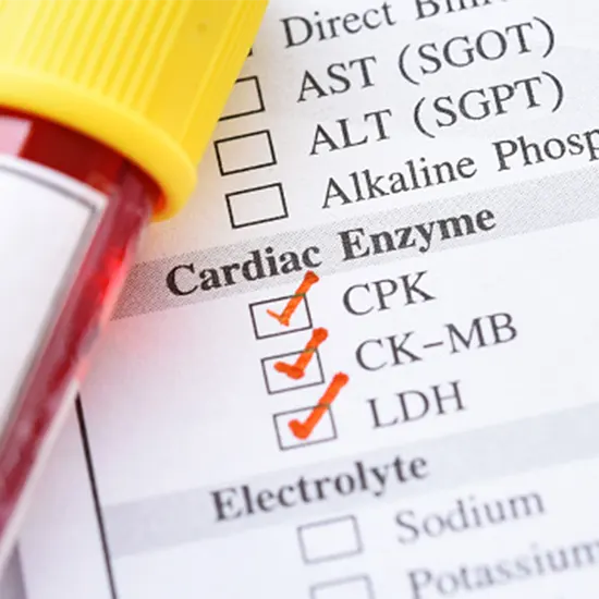 Cardiac Enzyme Panel Test in Delhi NCR, India | GDIC