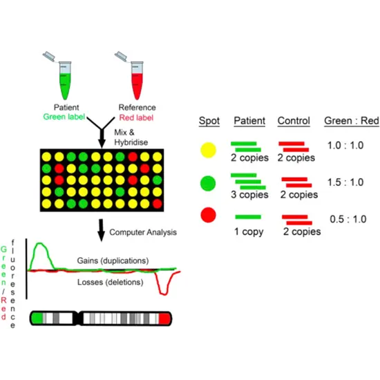 Chromosomal Microarray Analysis Test in Delhi NCR, India | GDIC