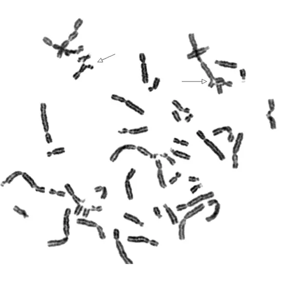 Chromosomal Studies (Fanconi Anemia) Test in Delhi NCR, India | GDIC